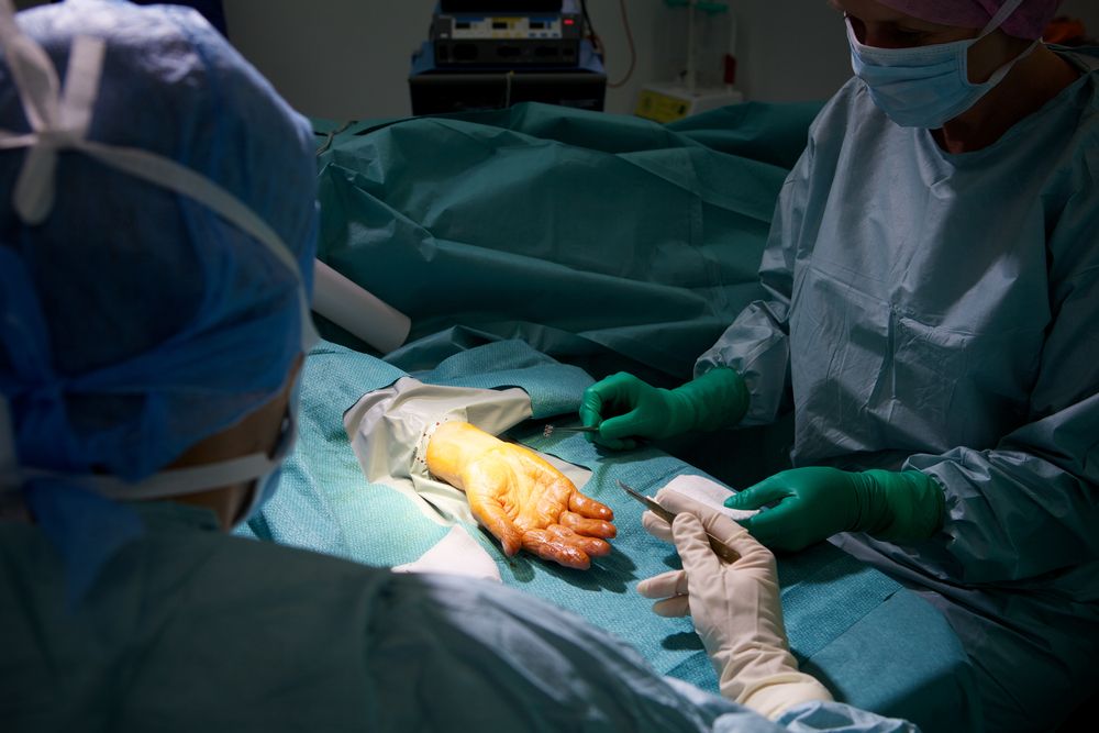 Common Surgeries For Treating Hand Pain | HealthAccess.com