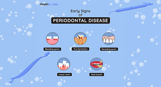 The Hidden Dangers of Cavities: More Than Just Tooth Pain ...